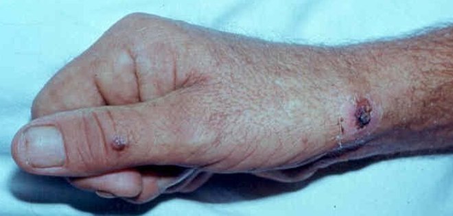 Aumentan a 84 las personas que habrían sido expuestas a ántrax en EE.UU.